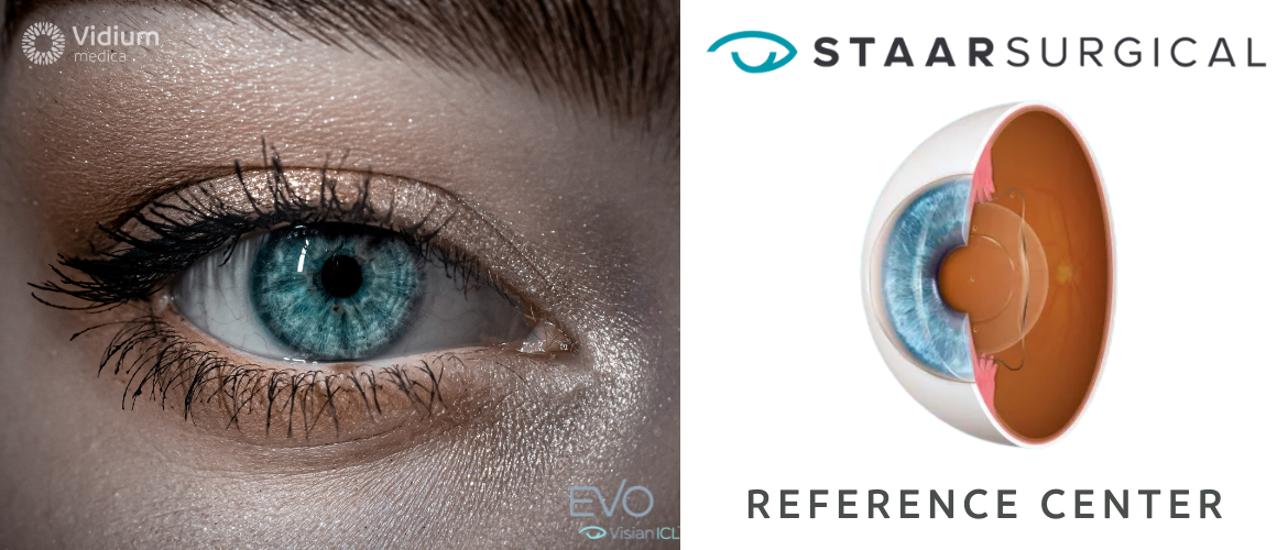 Soczewki Fakijne Evo Visian Icl Centrum Referencyjne Staar Surgical